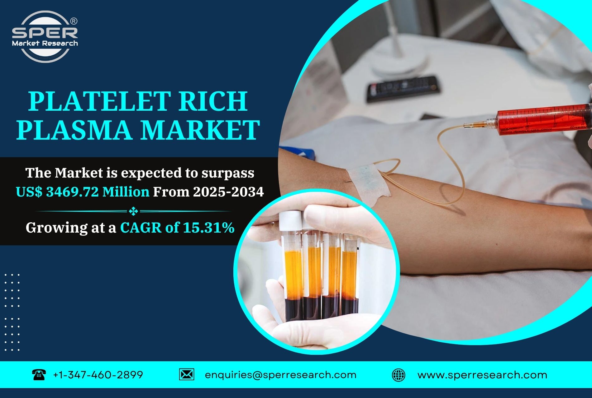 Platelet Rich Plasma Market Share, Scope, Analysis, Competition and Future Challenges: SPER ...
